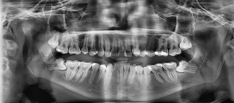 Oral Surgery by Best Dental Surgeon Dr Rimjhim Saran Bhatnagar